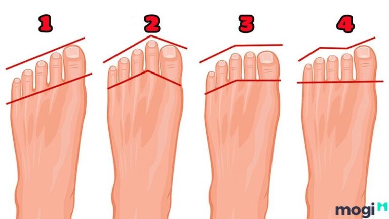 20+ Tướng Bàn Chân Nam Nữ Có Vận Mệnh Giàu Sang Phú Quý