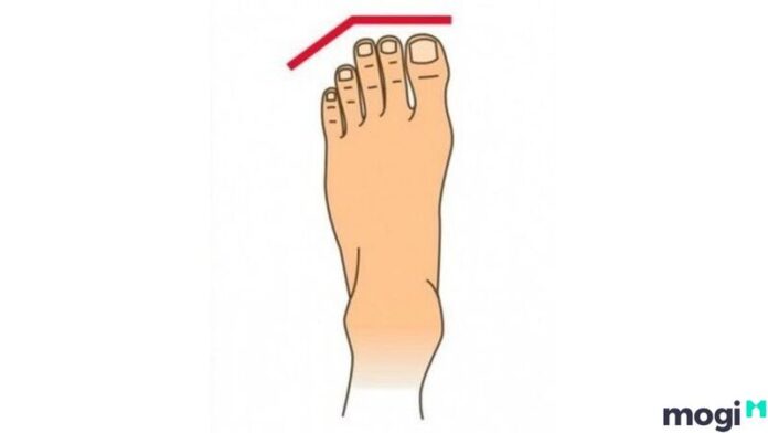 20+ Tướng Bàn Chân Nam Nữ Có Vận Mệnh Giàu Sang Phú Quý