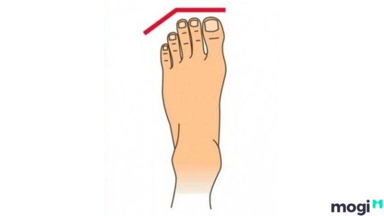 20+ Tướng Bàn Chân Nam Nữ Có Vận Mệnh Giàu Sang Phú Quý