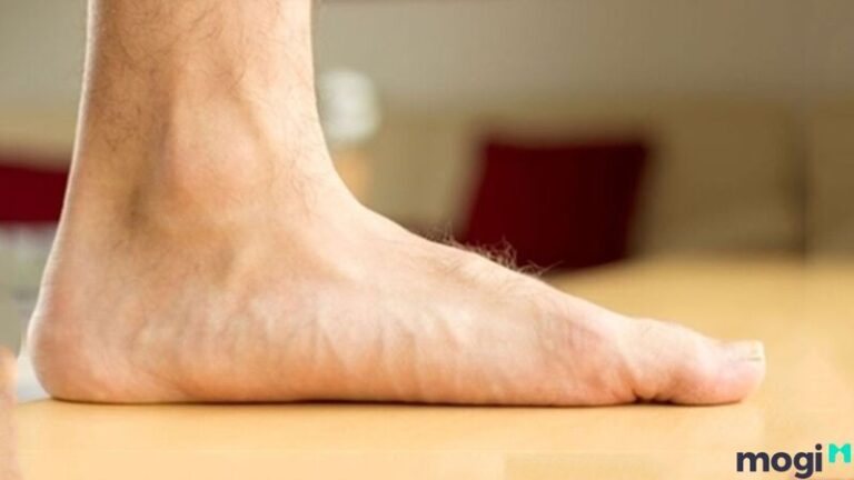 20+ Tướng Bàn Chân Nam Nữ Có Vận Mệnh Giàu Sang Phú Quý